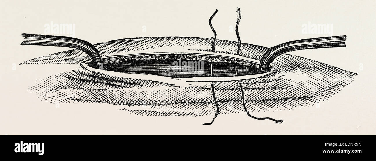 Blunt Stock Photos & Blunt Stock Images - Alamy