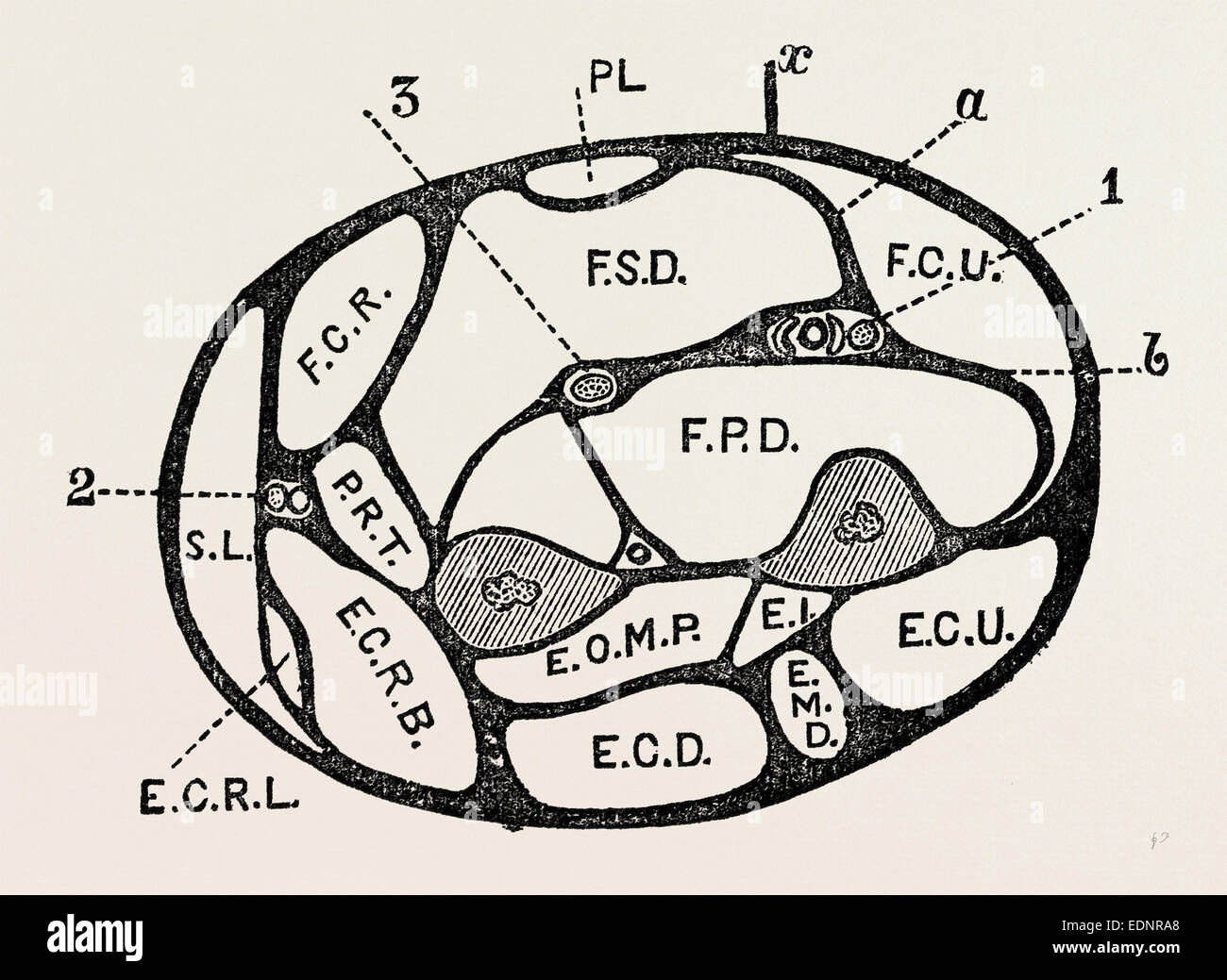 section of the forearm, medical equipment, surgical instrument, history ...