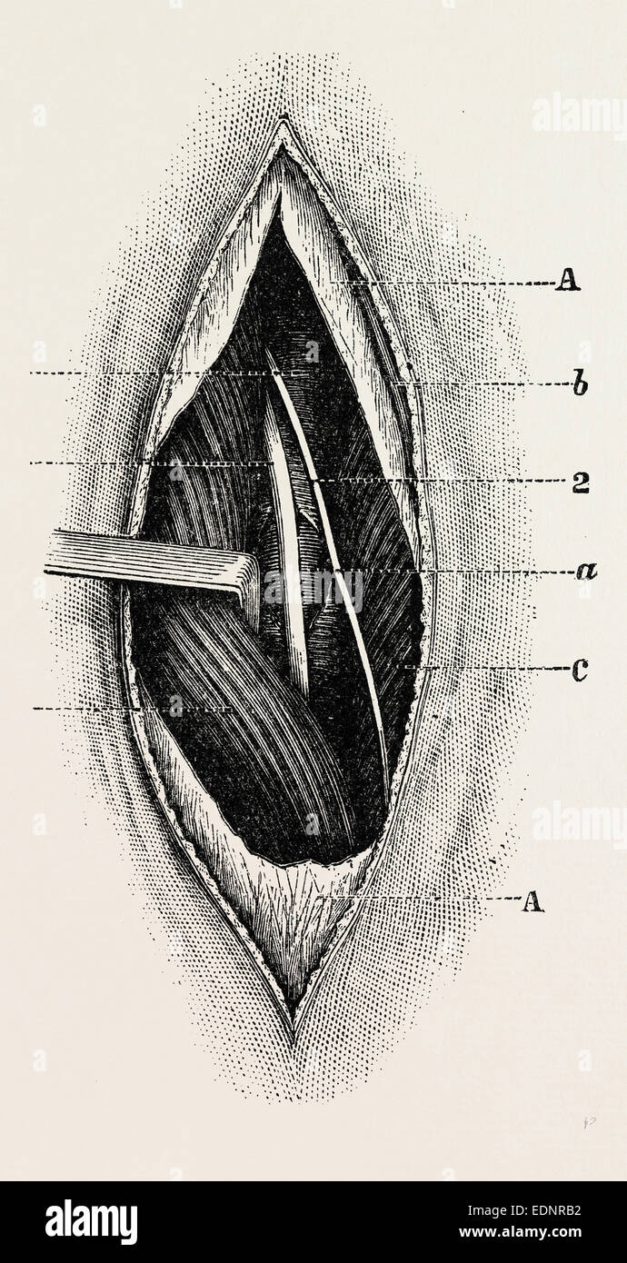 Saphenous nerve hi-res stock photography and images - Alamy