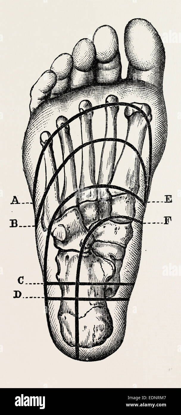 plantar incisions, medical equipment, surgical instrument, history of ...
