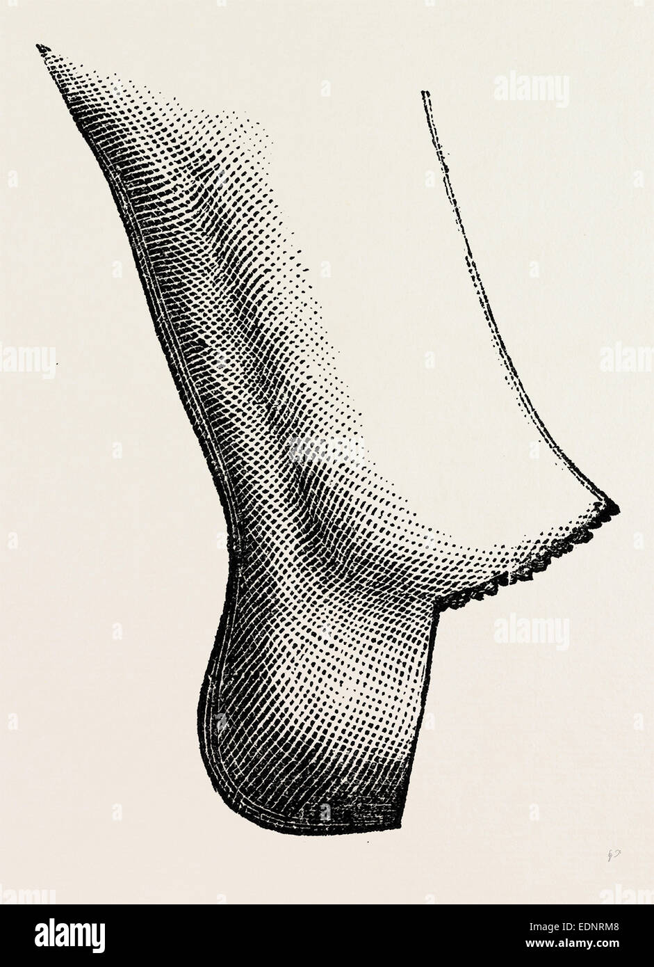 Symes amputation hi-res stock photography and images - Alamy