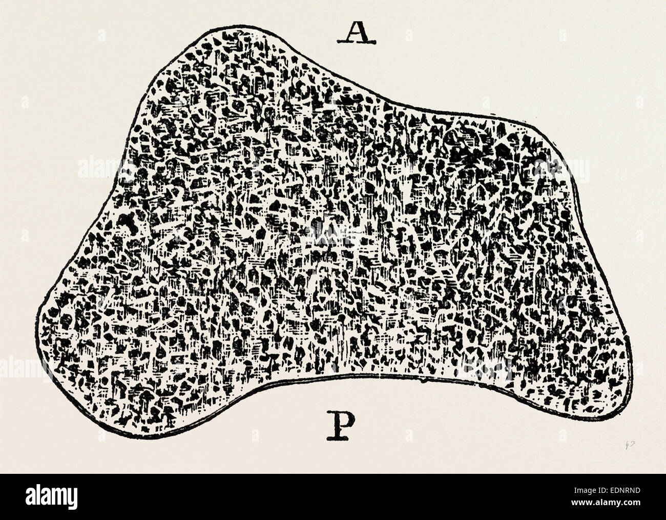 transverse section, medical equipment, surgical instrument, history of ...