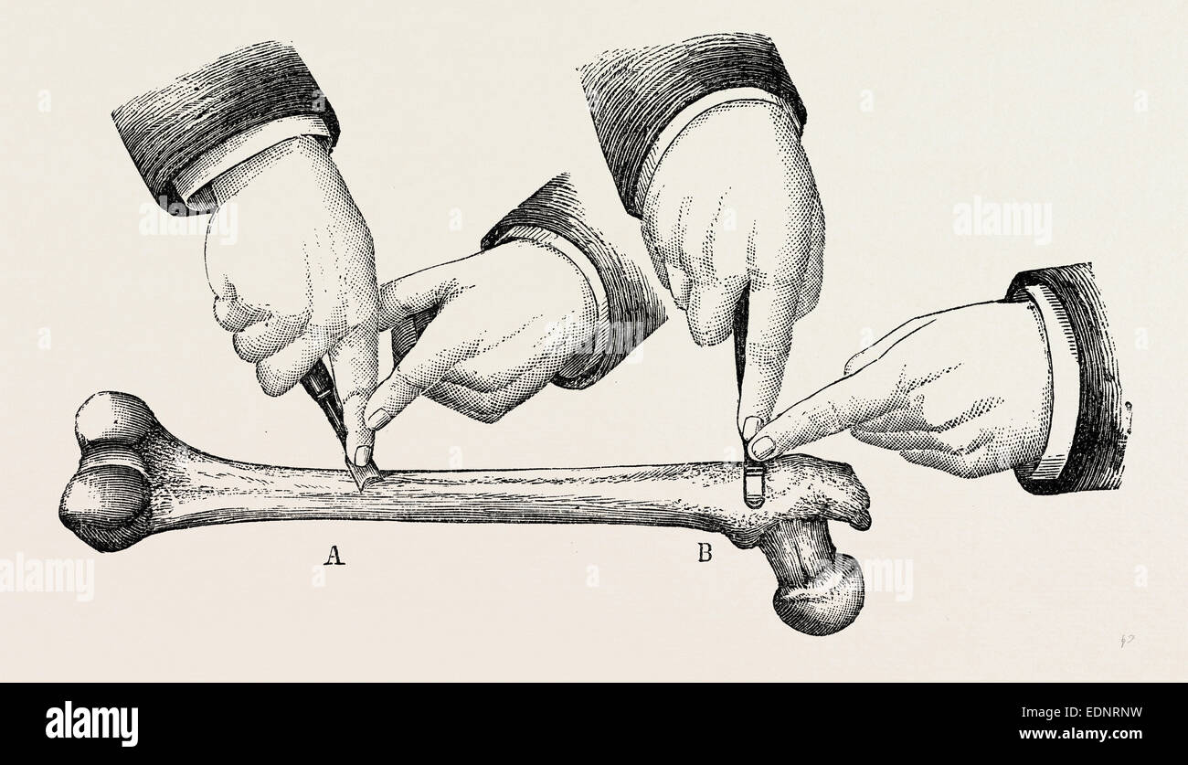 Using the rugine hi-res stock photography and images - Alamy