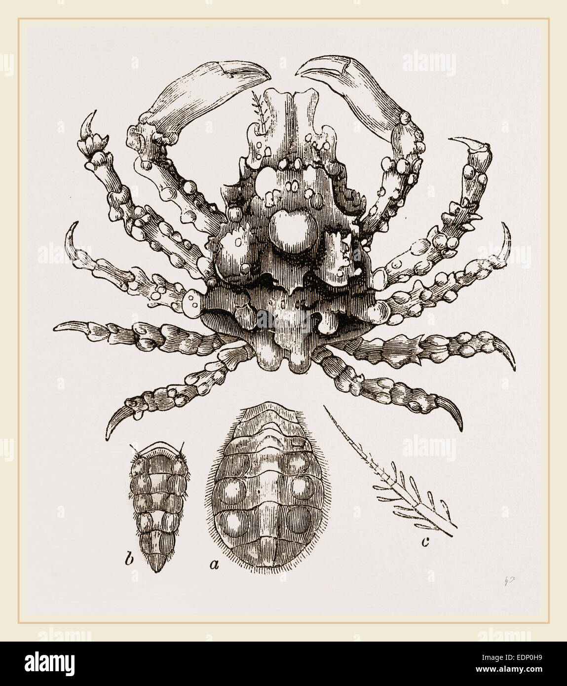 Chiragra hi-res stock photography and images - Alamy