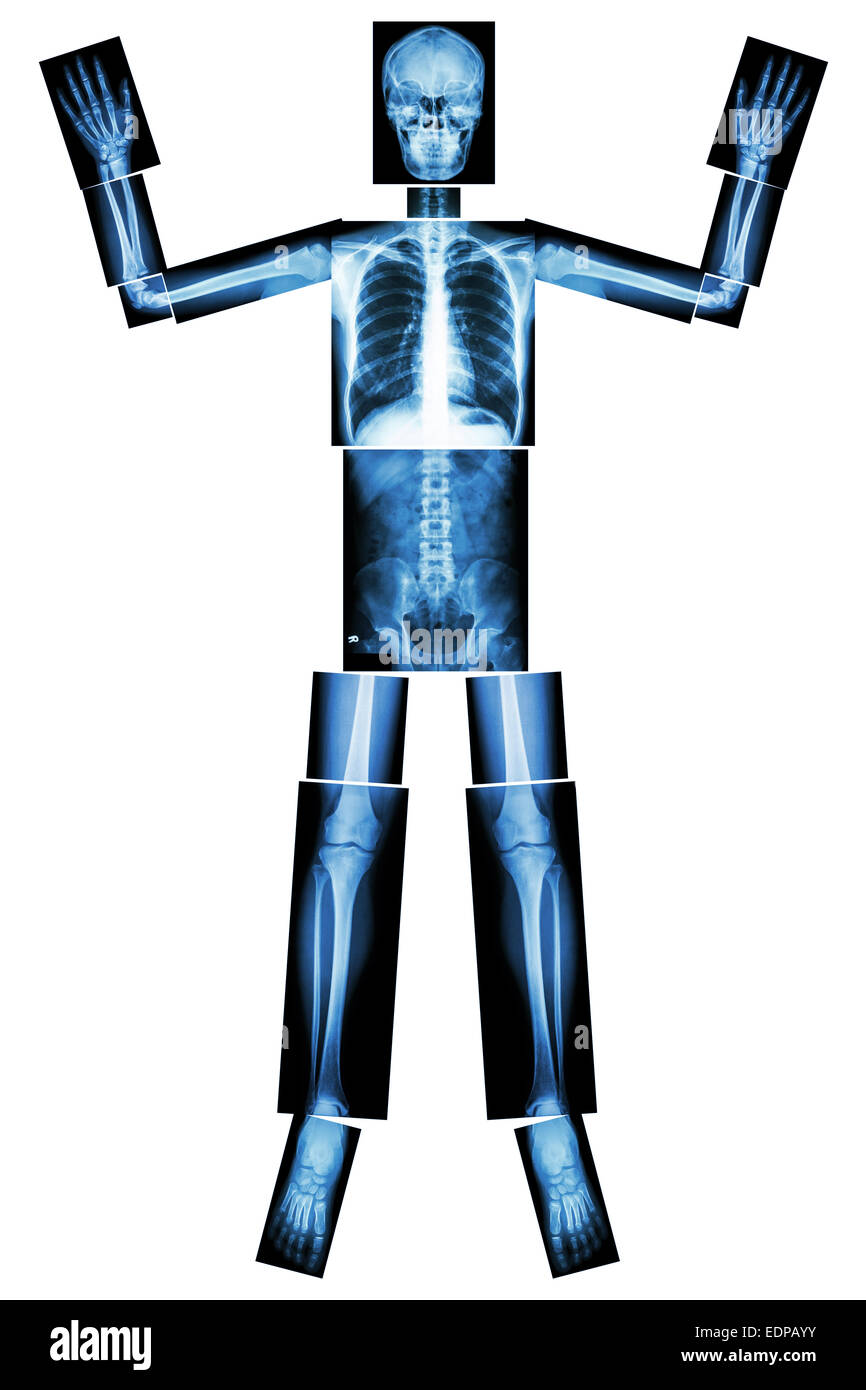 Ebola patient hi-res stock photography and images - Alamy