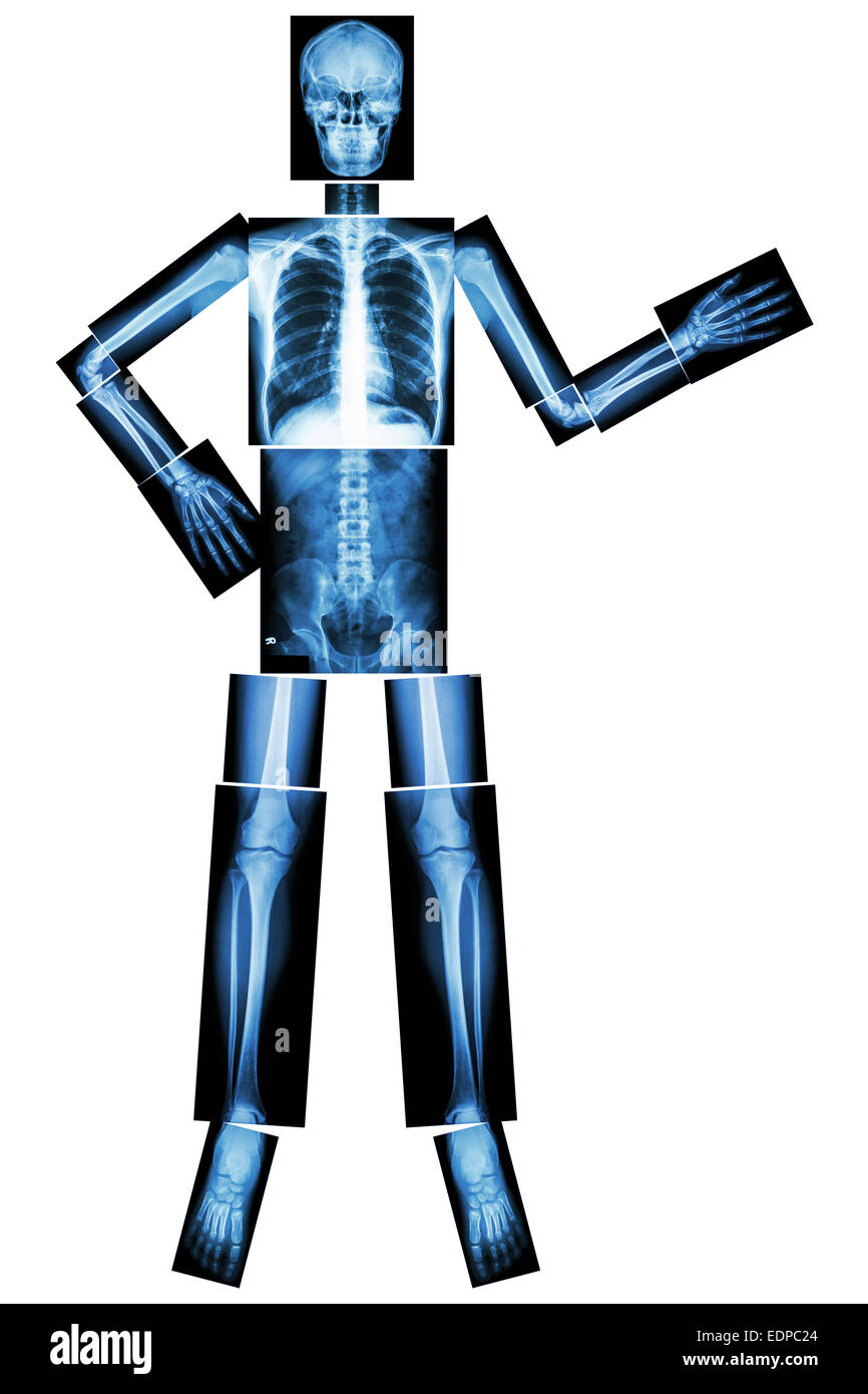 Human skeleton present something (Whole body : head skull neck spine ...