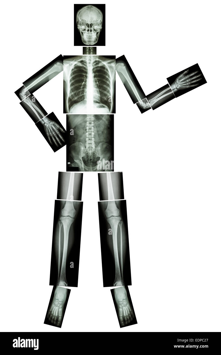 Human skeleton present something (Whole body : head skull neck spine ...