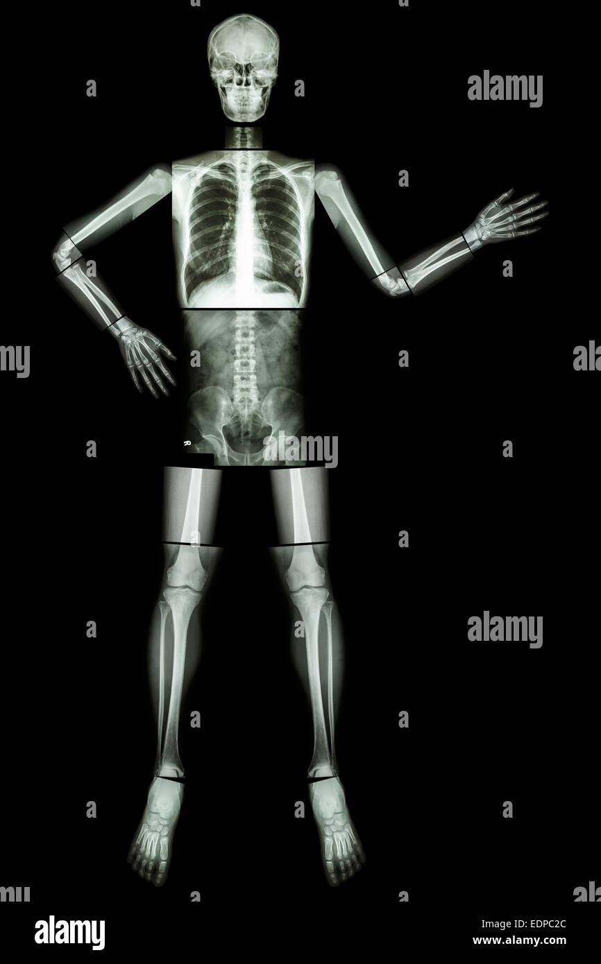 Human skeleton present something (Whole body : head skull neck spine ...