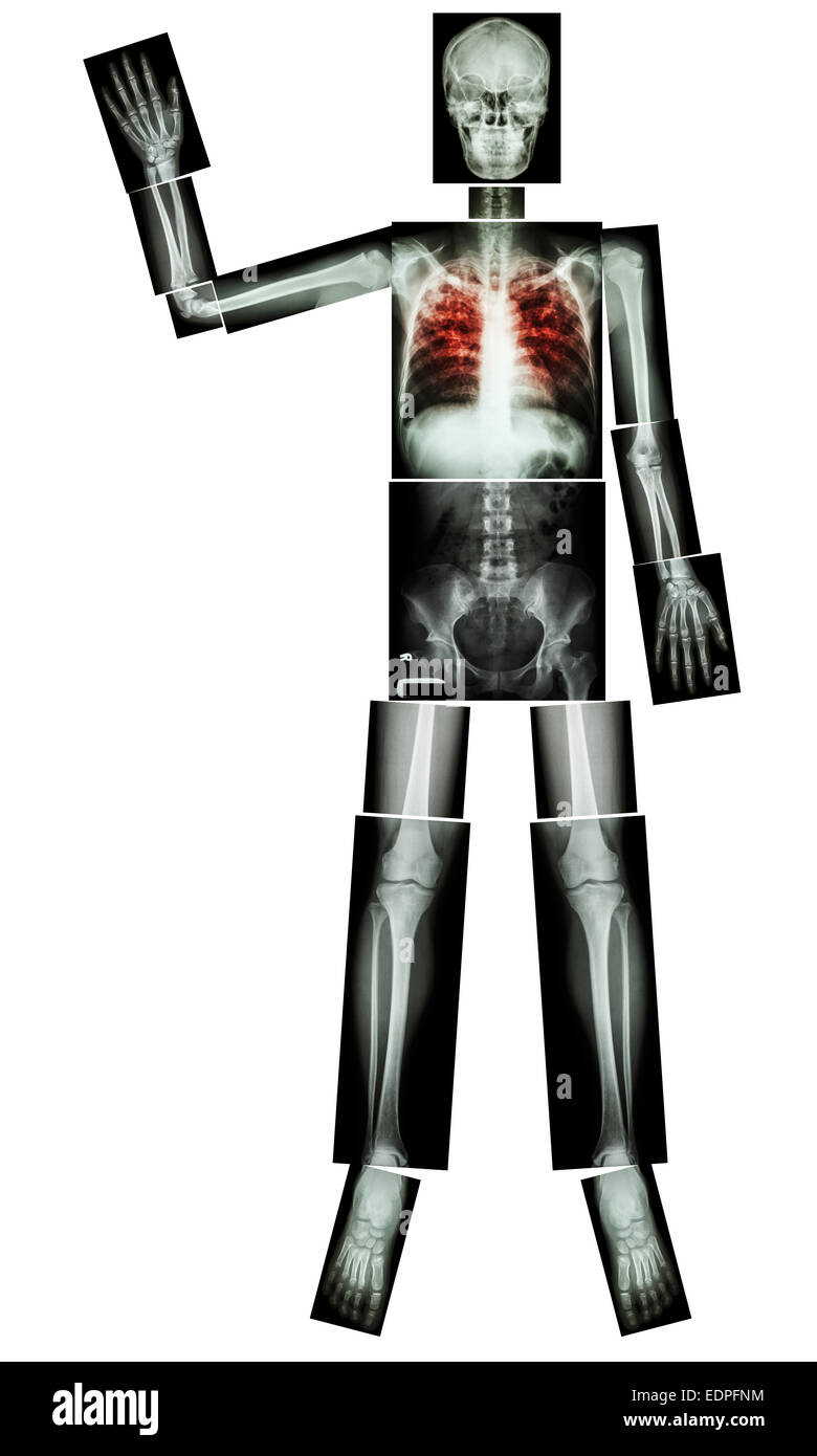 Whole skull Cut Out Stock Images & Pictures - Alamy