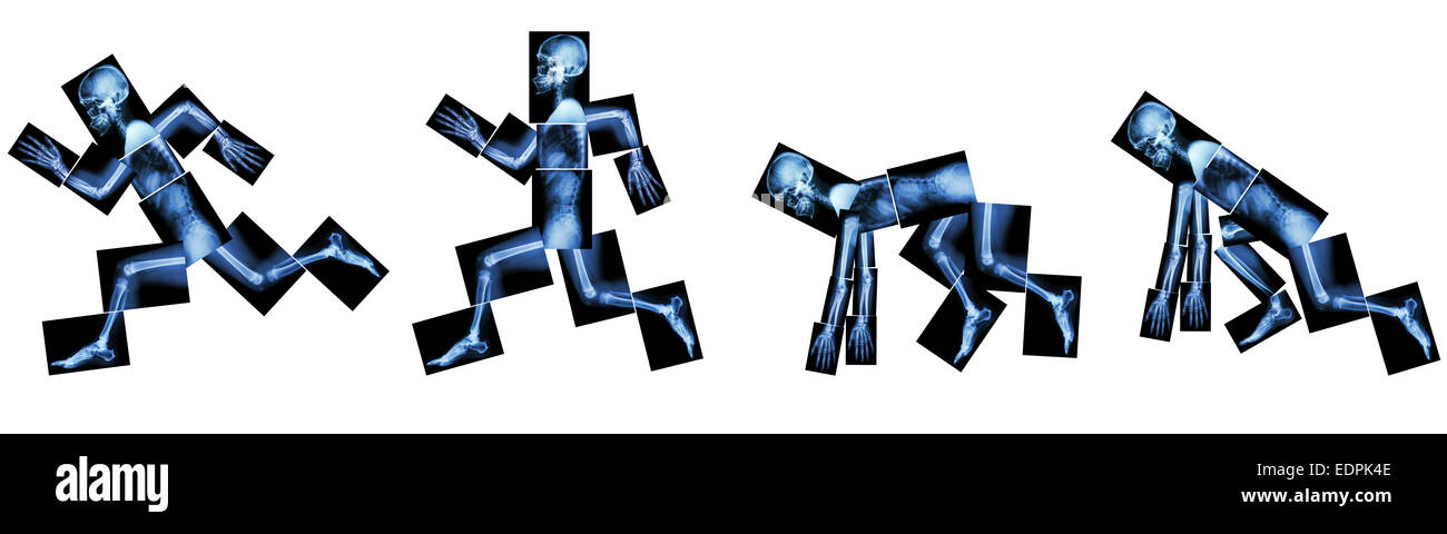 human bone is running. (step of run a race),(Whole body : head neck ...