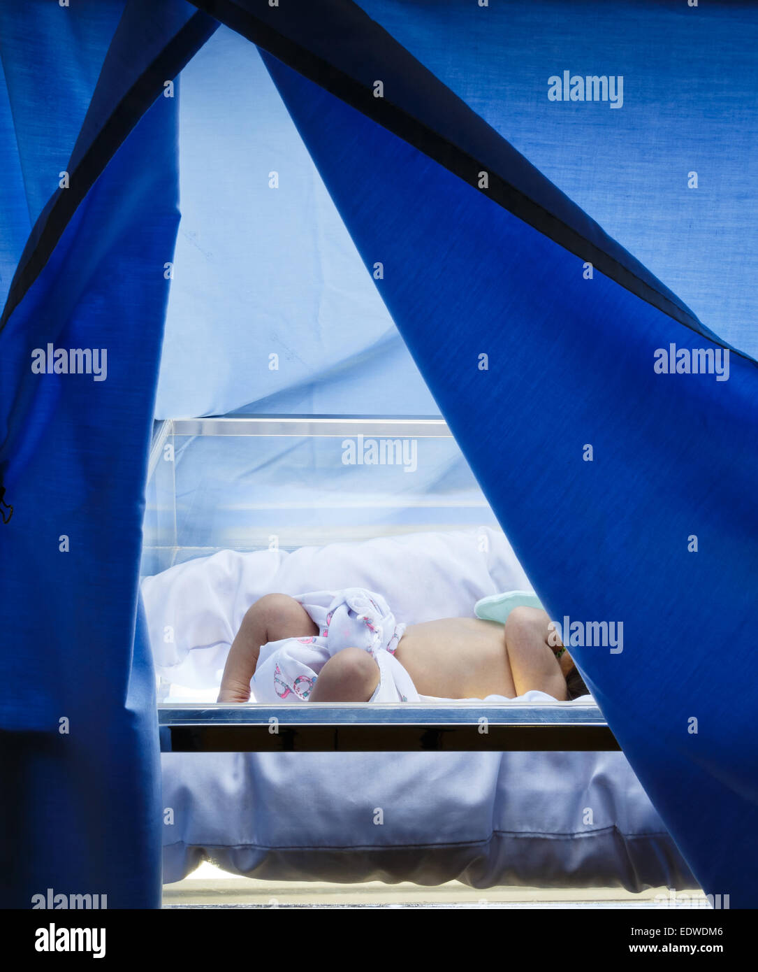 Neonatal jaundice hi-res stock photography and images - Alamy