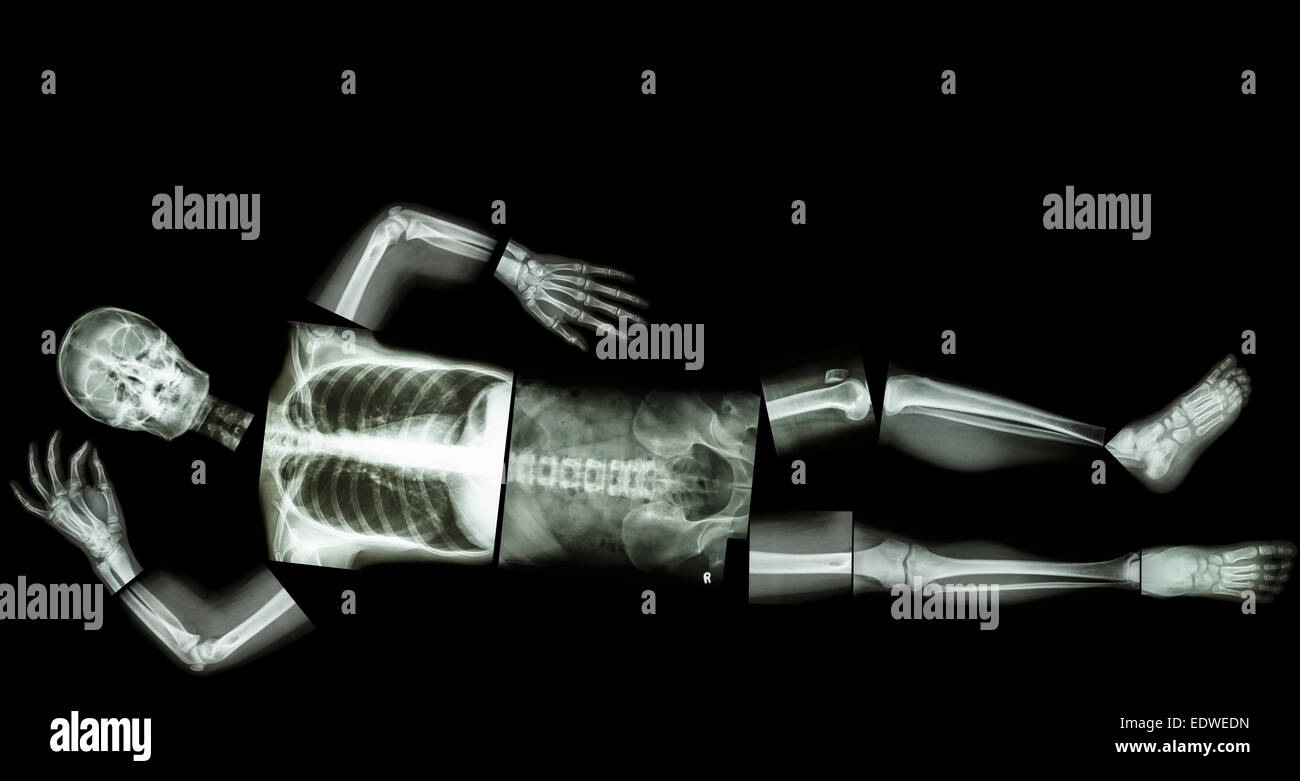 Upper body skeleton hi-res stock photography and images - Alamy