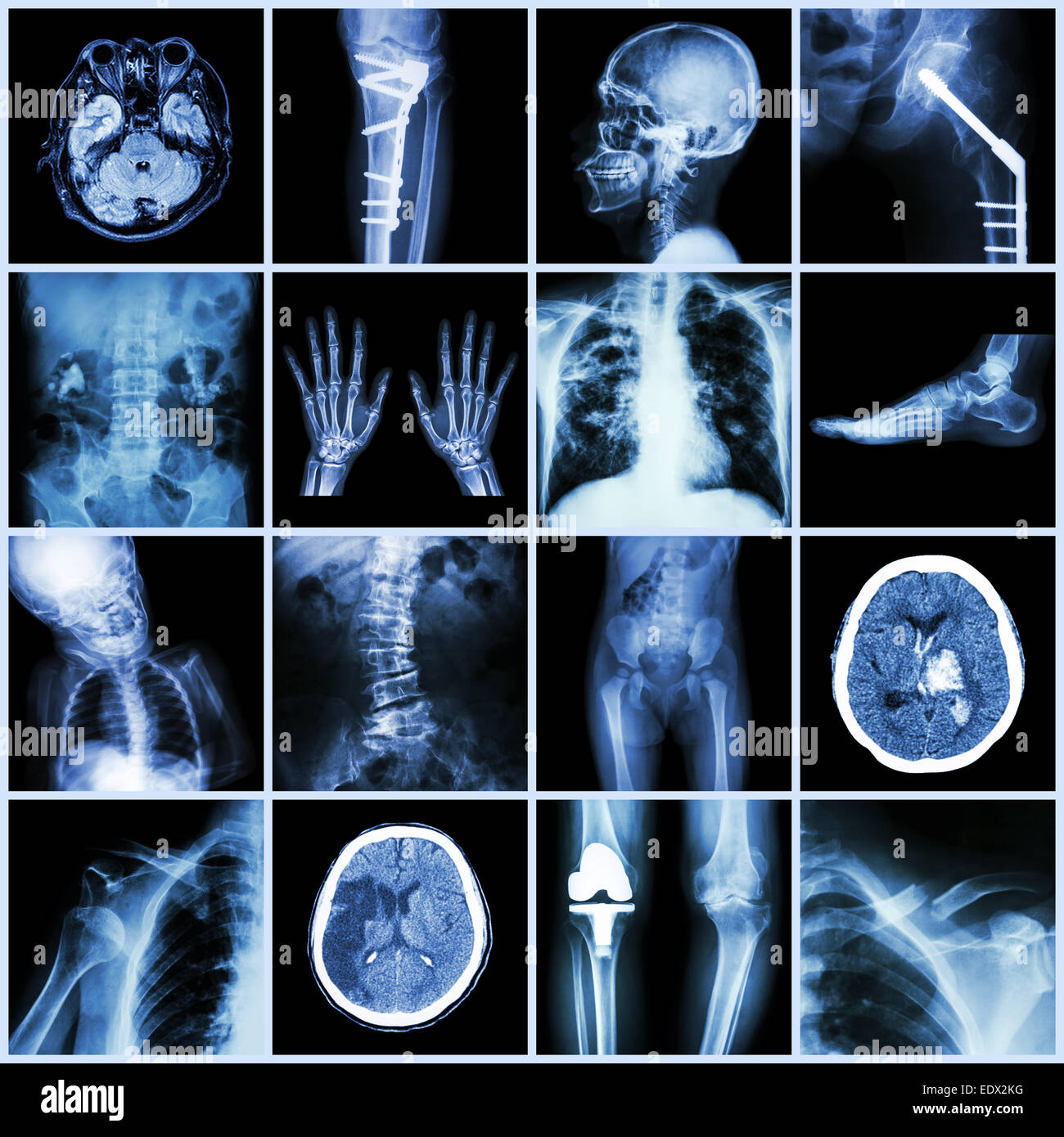 Orthopedic Surgeon X Rays