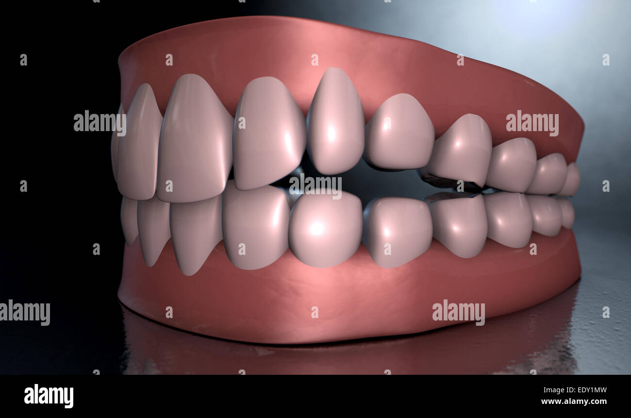 A sinister dramatic depiction of seperated upper and lower sets of ...