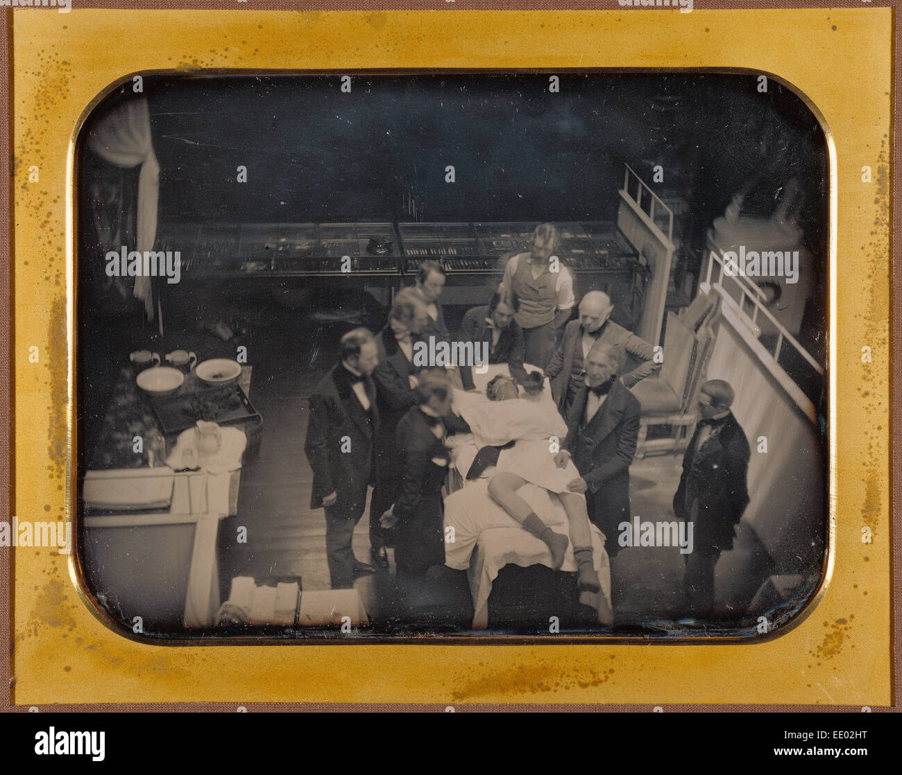 Early Operation Using Ether for Anesthesia; Southworth & Hawes ...