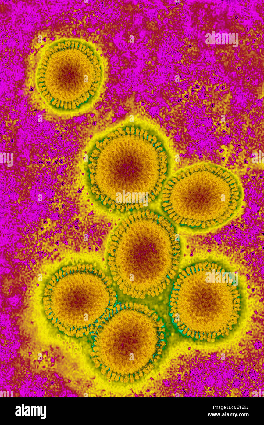 INFLUENZA VIRUS, TEM Stock Photo - Alamy INFLUENZA VIRUS, TEM Stock Photo - Alamy