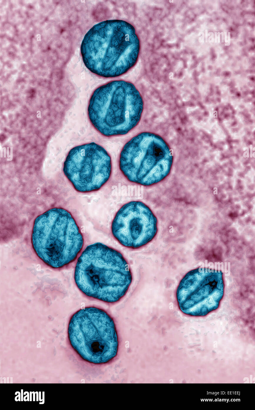 Hiv aids microscope hi-res stock photography and images - Alamy