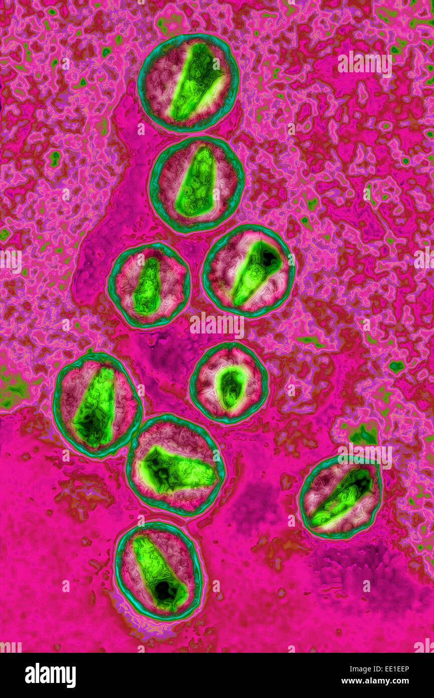 Hiv aids microscope hi-res stock photography and images - Alamy