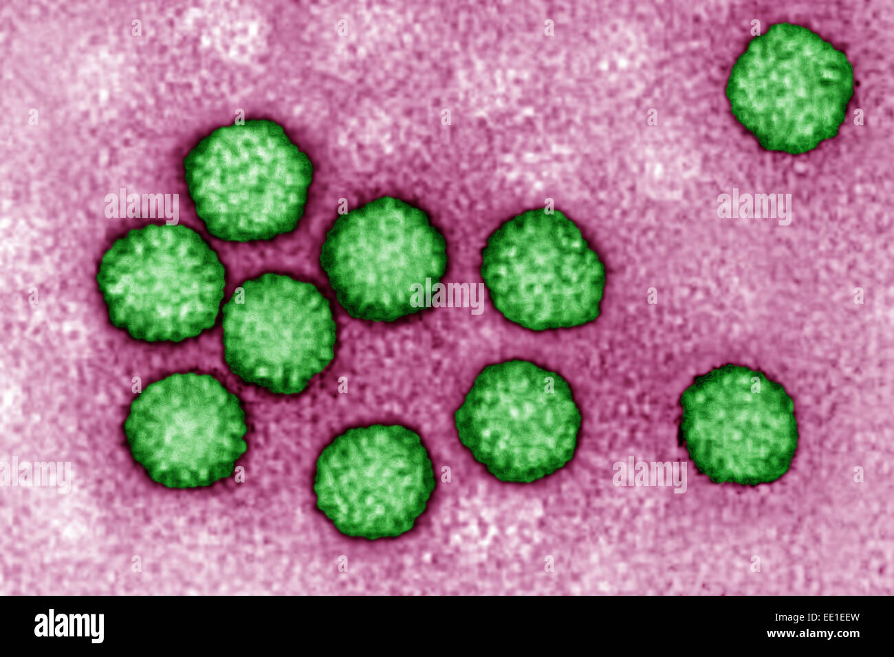 Human papillomavirus hi-res stock photography and images - Alamy