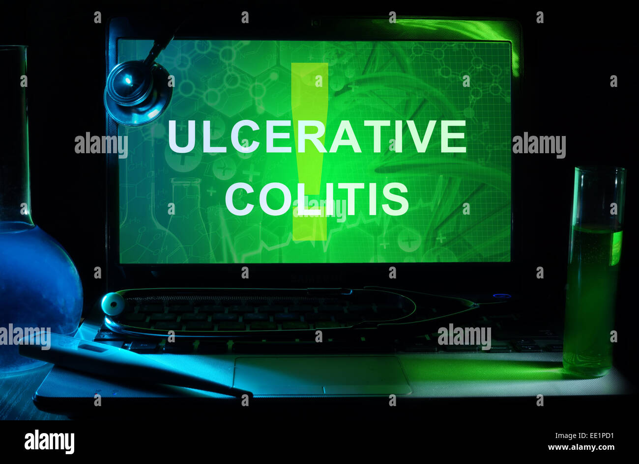 Ulcerative colitis research hi-res stock photography and images - Alamy