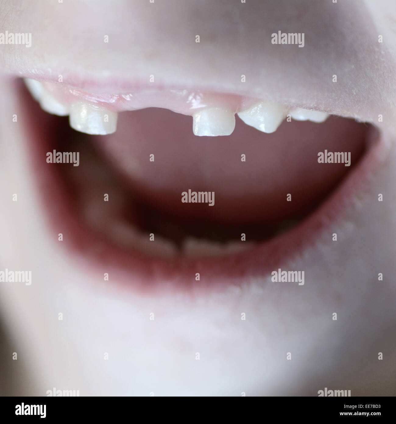 Little child smiling portrait missing front tooth Stock Photo - Alamy