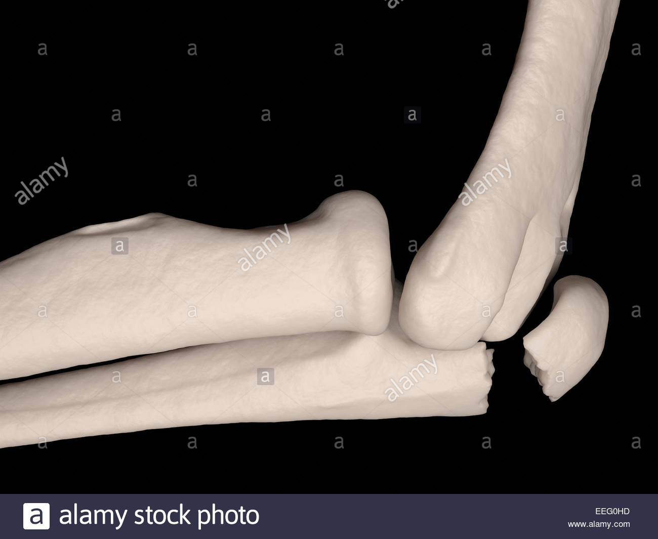 Human Forearm Bone High Resolution Stock Photography and Images - Alamy