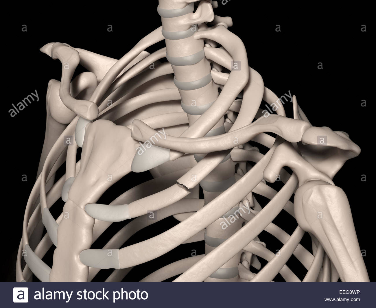 Broken Rib Stock Photos & Broken Rib Stock Images - Alamy