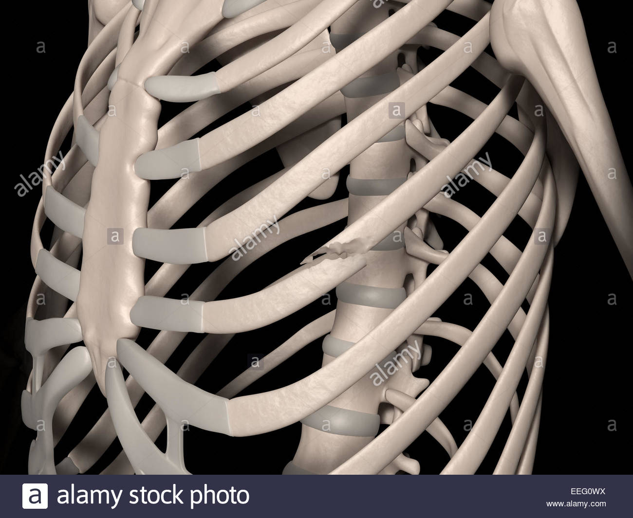 Broken Rib Cage High Resolution Stock Photography and Images - Alamy