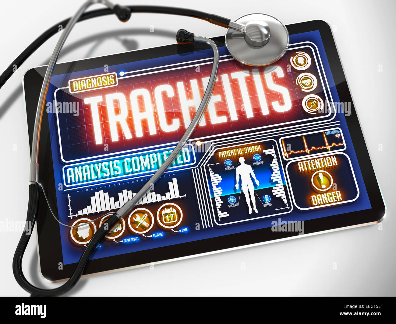 Tracheitis on the Display of Medical Tablet Stock Photo - Alamy