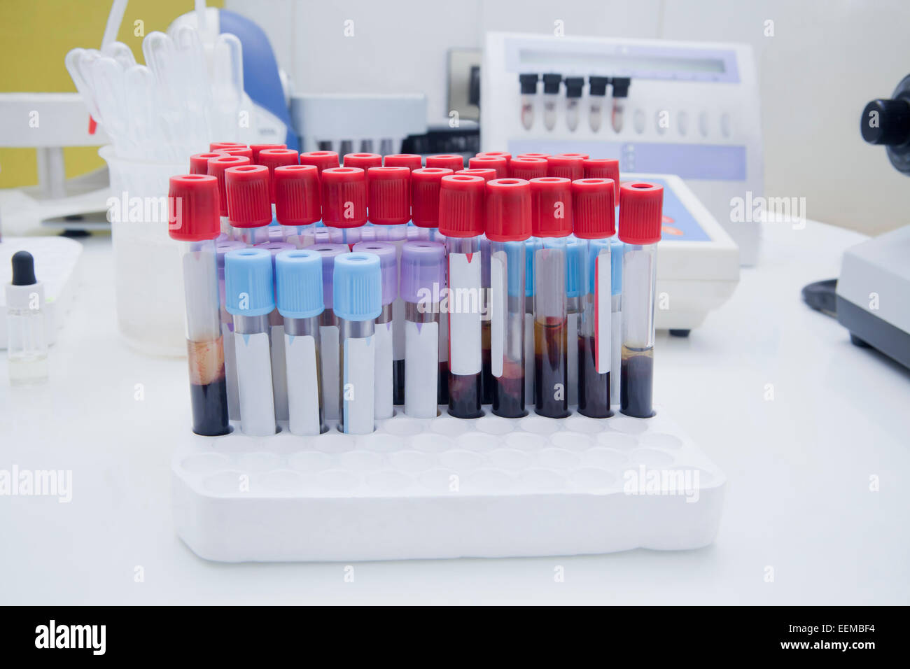 Close up of blood samples in test tube rack in laboratory Stock Photo ...