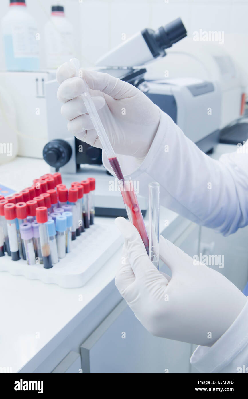 Hispanic scientist pipetting blood sample in laboratory Stock Photo - Alamy