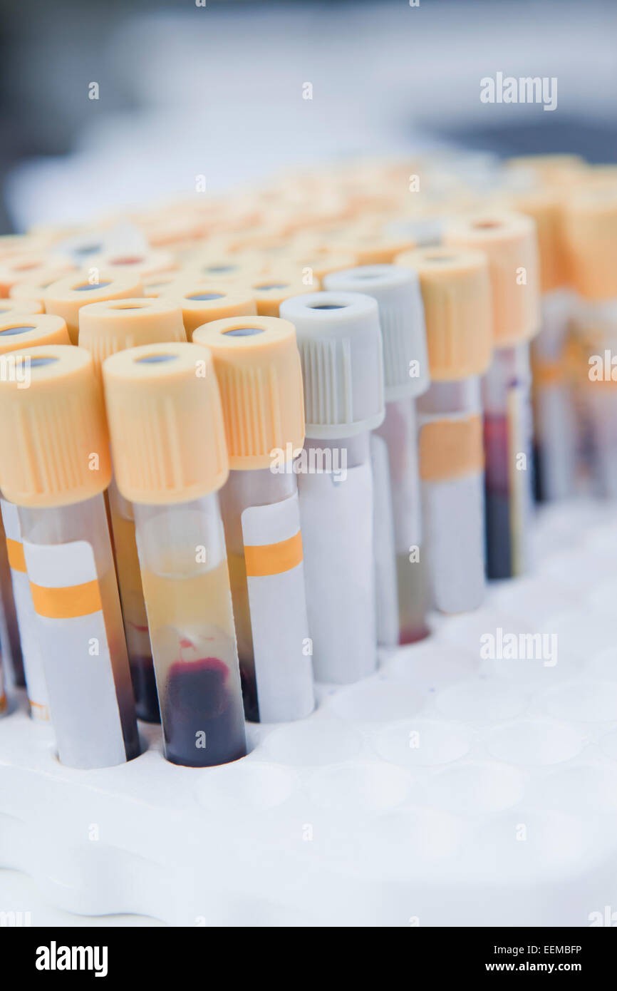 Close up of blood samples in test tube rack in laboratory Stock Photo ...