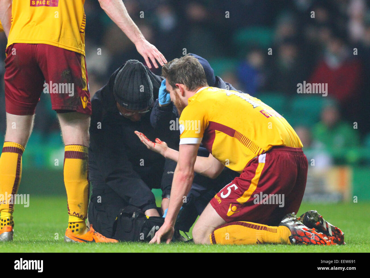 Knock head scotland hi-res stock photography and images - Alamy