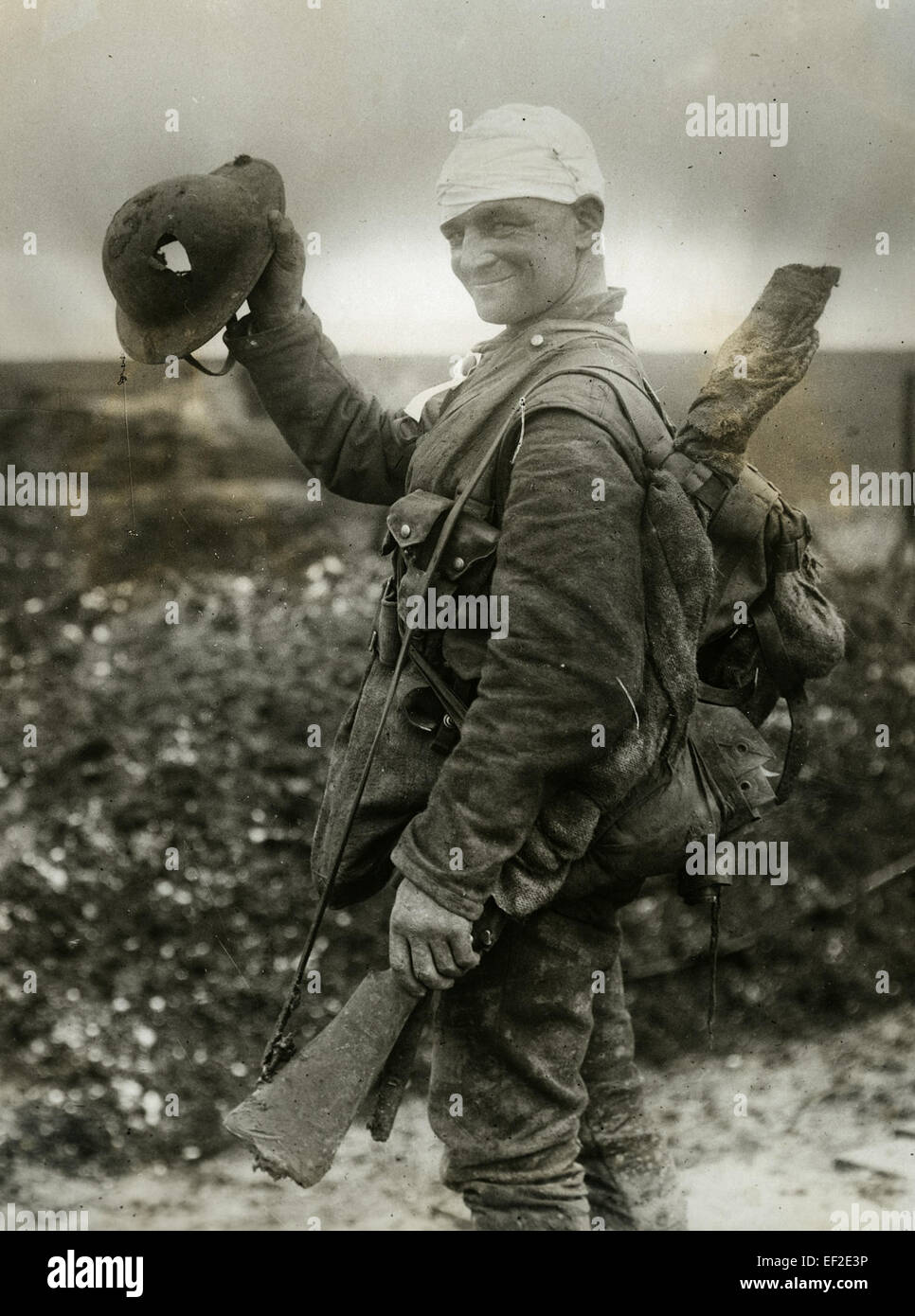 A soldier, who was wounded, was saved by his shrapnel helmet while on ...
