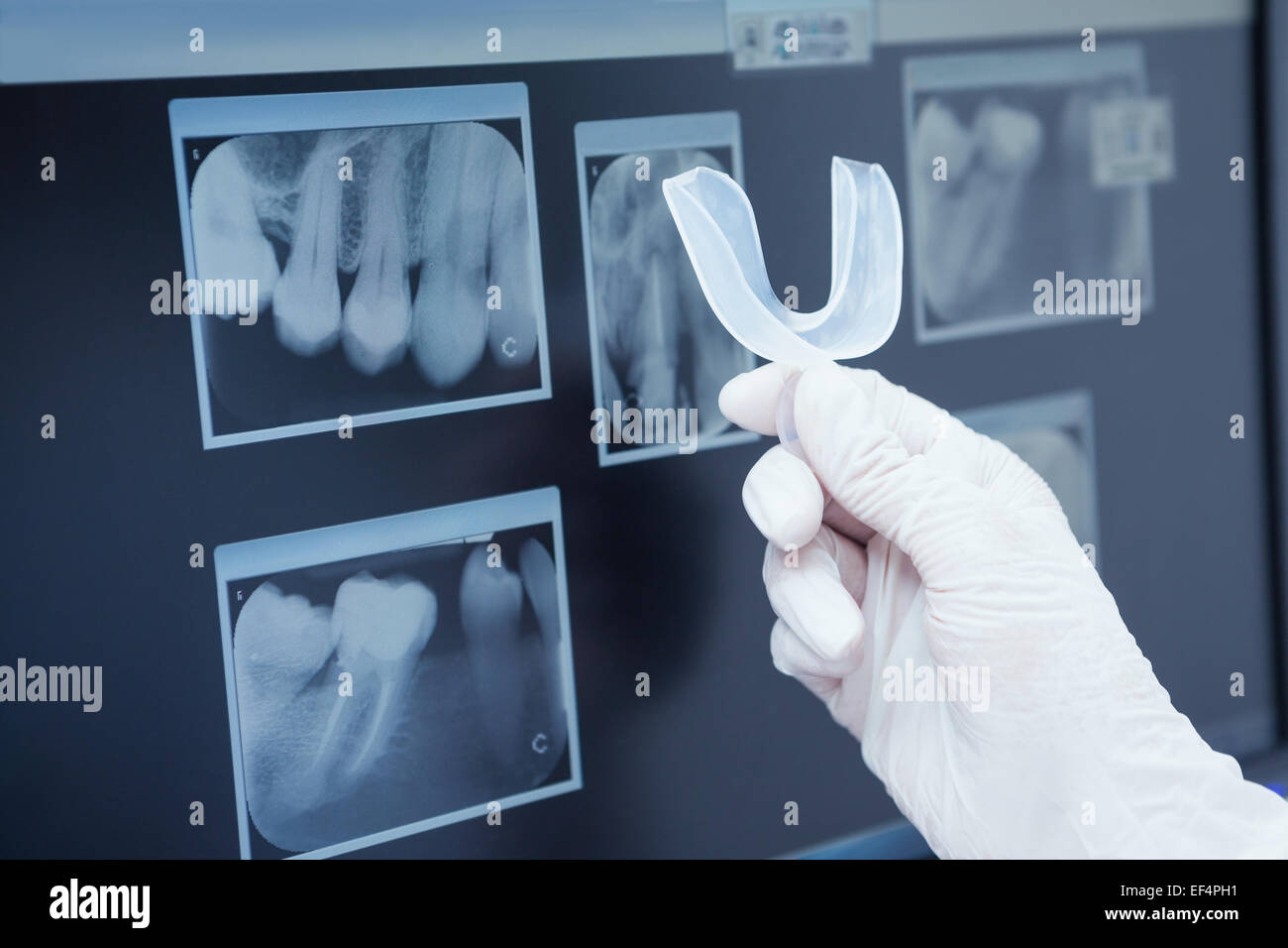Teeth x ray hi-res stock photography and images - Alamy