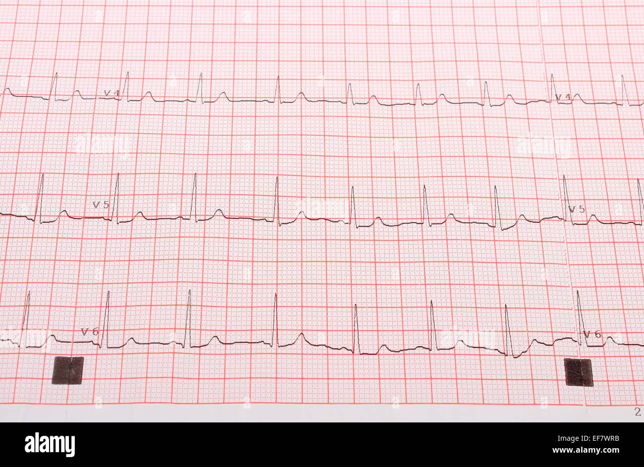 Electrocardiogram ekg hi-res stock photography and images - Alamy
