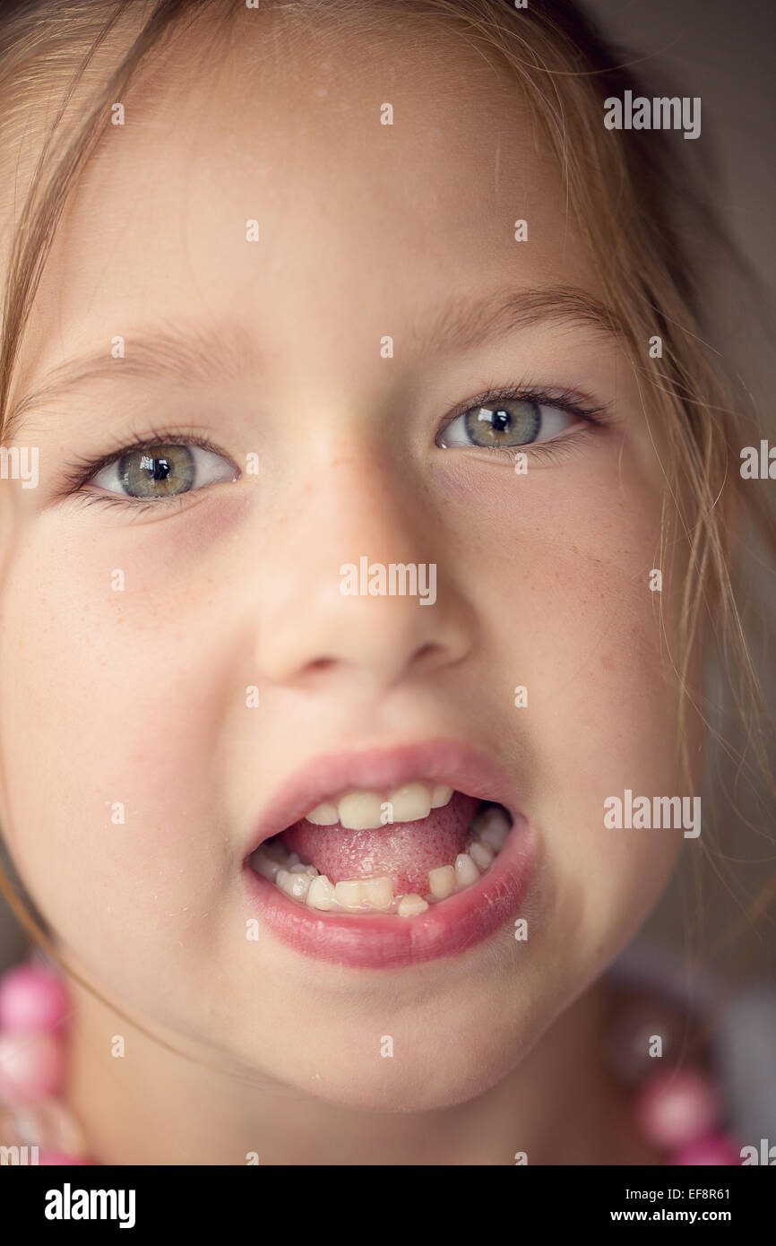 Loose tooth hi-res stock photography and images - Alamy