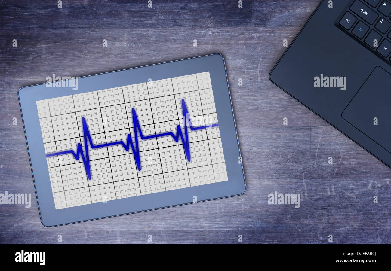Electrocardiogram on a tablet - Concept of healthcare, heartbeat shown ...