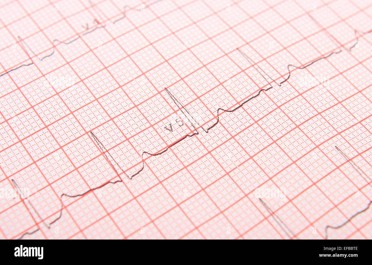 Electrocardiogram graph ekg heart rhythm, medicine concept Stock Photo ...