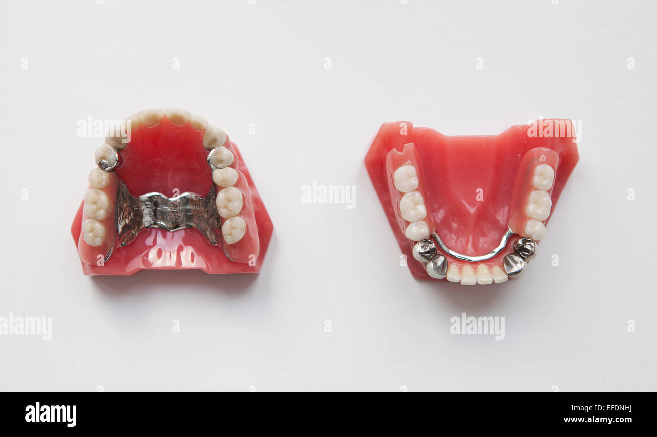 two artificial dentures against white background Stock Photo - Alamy two artificial dentures against white background Stock Photo - Alamy