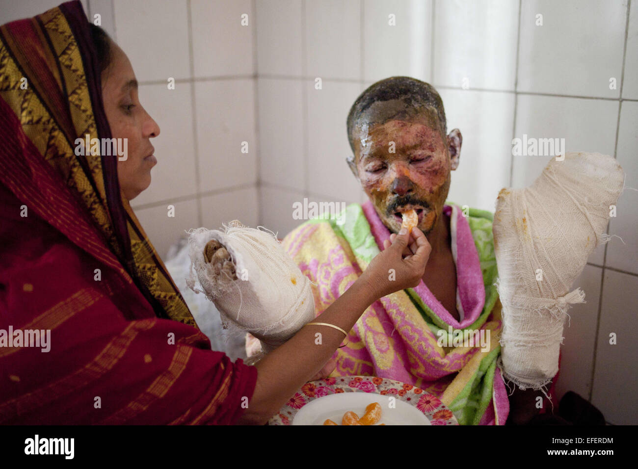 Dhaka, Bangladesh. 2nd Feb, 2015. Jamir Ali, 40, day labor, a victim of ...