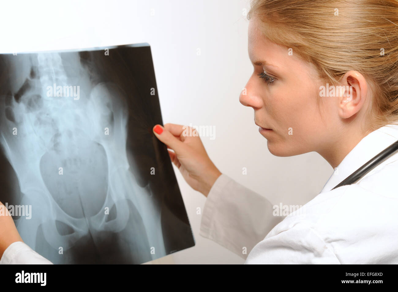 Female doctor examining an x-ray image Stock Photo - Alamy