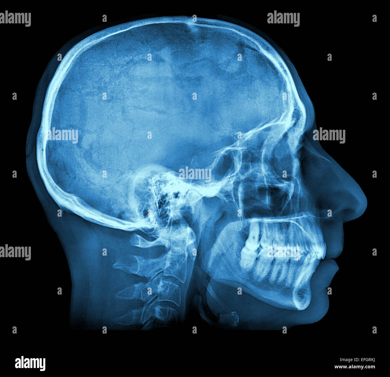 Skeleton head xray hi-res stock photography and images - Alamy