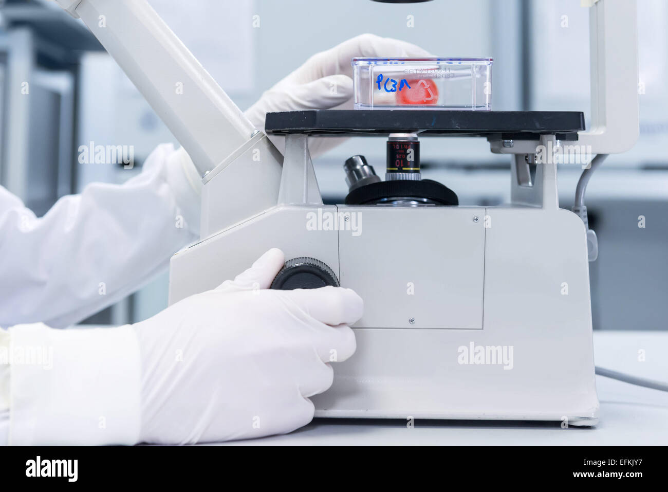 Cancer cells under microscope hi-res stock photography and images - Alamy