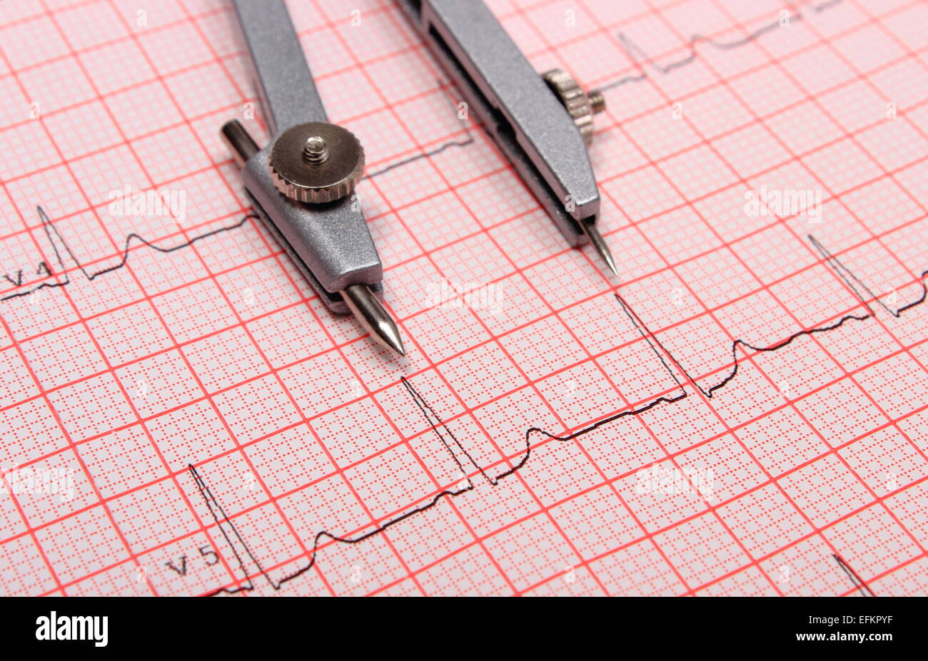 Electrocardiogram graph and calipers, ekg heart rhythm, medicine ...