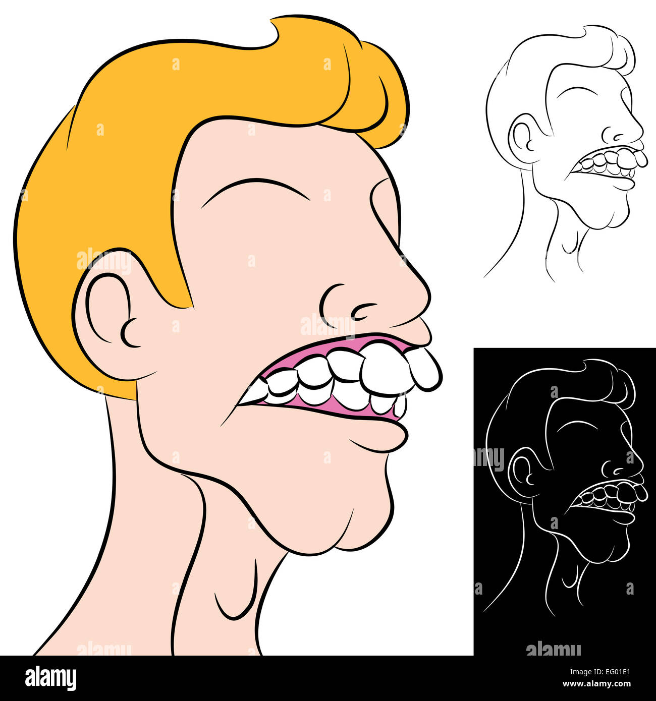 An image of a man with a dental overbite Stock Photo - Alamy