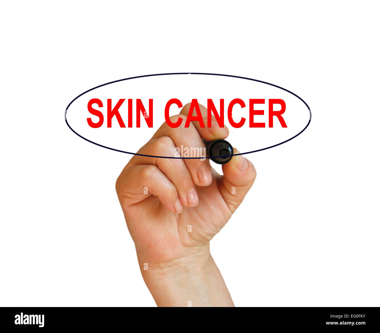 writing word SKIN CANCER with marker on white background made in 2d ...