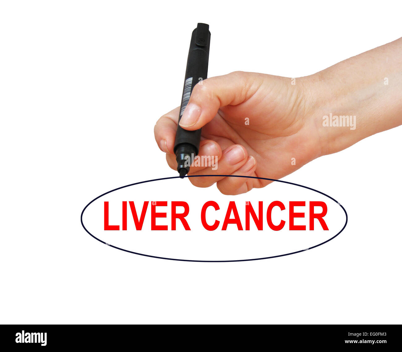 Liver disease cells Cut Out Stock Images & Pictures - Alamy