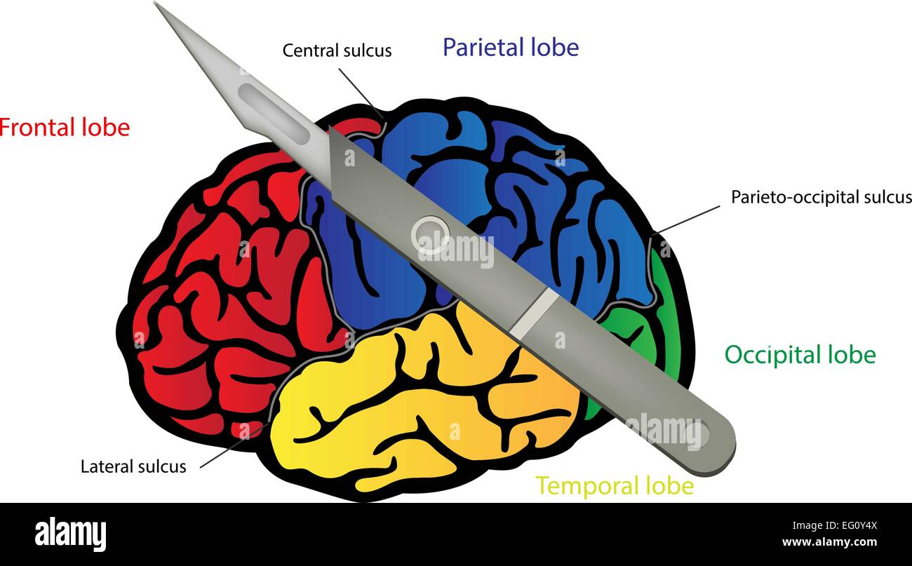 Brain surgery hi-res stock photography and images - Alamy