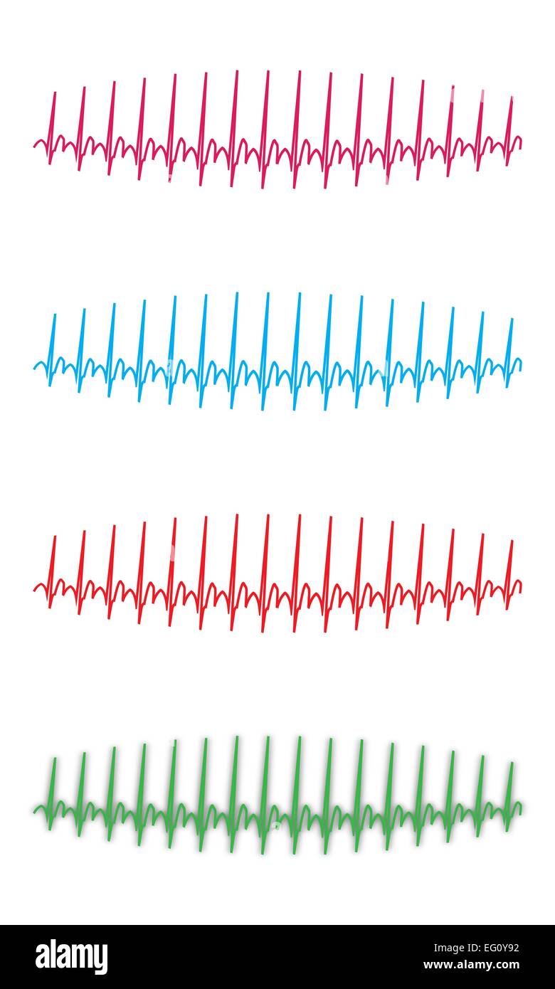 Ecg traces Cut Out Stock Images & Pictures - Alamy